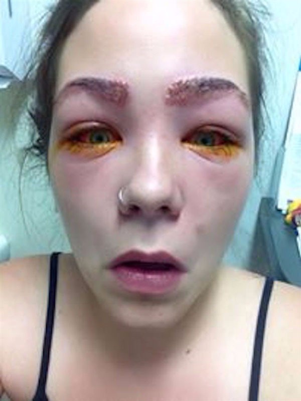 فتاة تتحول لضفدع بعد صبغ حواجبها .. صور